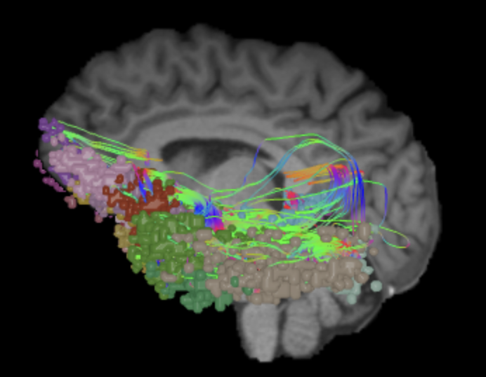 Limbic/Paralimbic System - Connectome Guide